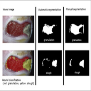 Mobile Structure Sensor for Real-Time 3D Wound Assessment: Ex-Vivo ...