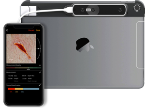 Advanced wound imaging | Wound measurement | Wound care App