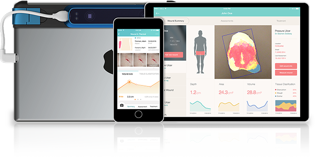 Wound Measurement | 3D 2D Digital Planimetry Data | ekare Inc. USA