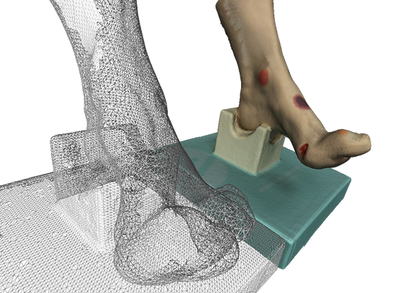 Wound Measurement | 3D 2D Digital Planimetry Data | ekare Inc. USA