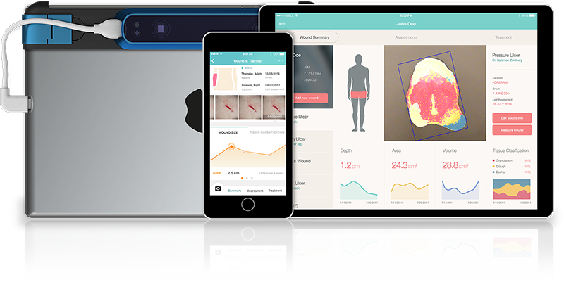 Wound Measurement for Healthcare Providers | Patient outcomes | ekare ...