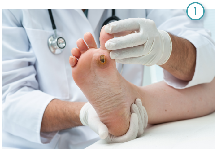 Digital Wound Imaging | Wound Care Research | Wound Care App