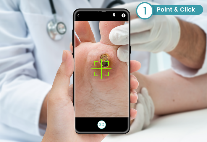 Wound Measurement | Mobile Wound Care | Wound Imaging App